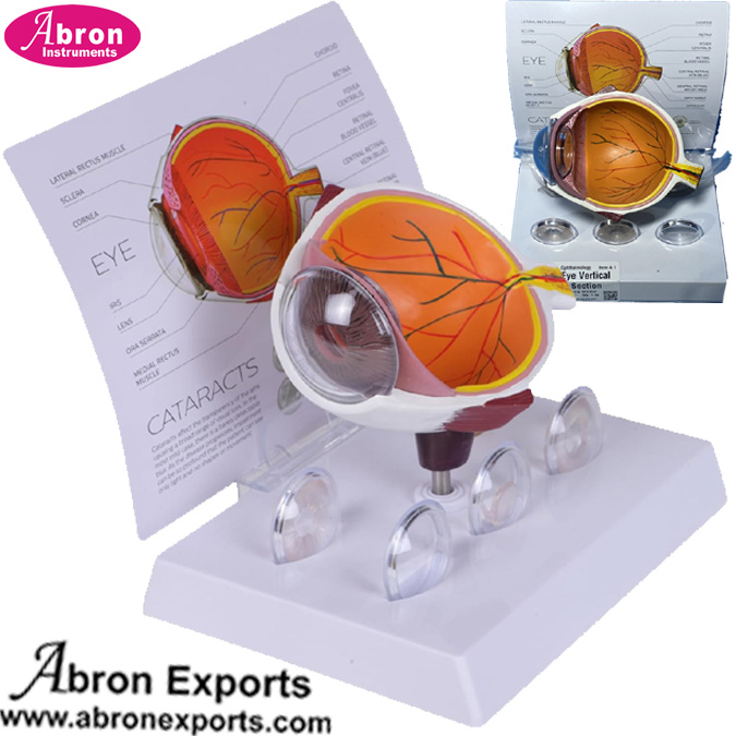 Model Human Eye Schematic Cataract VS 5 Interchangeable Lenses Perfect ...